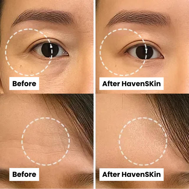 V-Roller Pro – HavenSkin